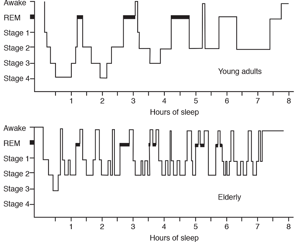 AP Psychology Practice Test 12: States of Consciousness_APstudy.net